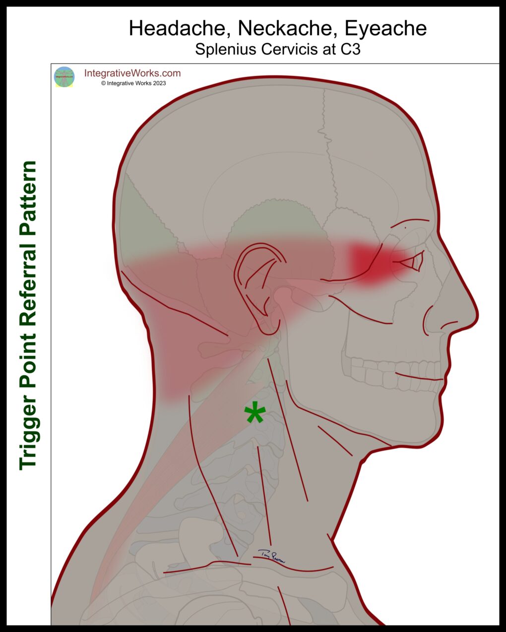Neck-ache Headache, Eye-ache - Integrative Works