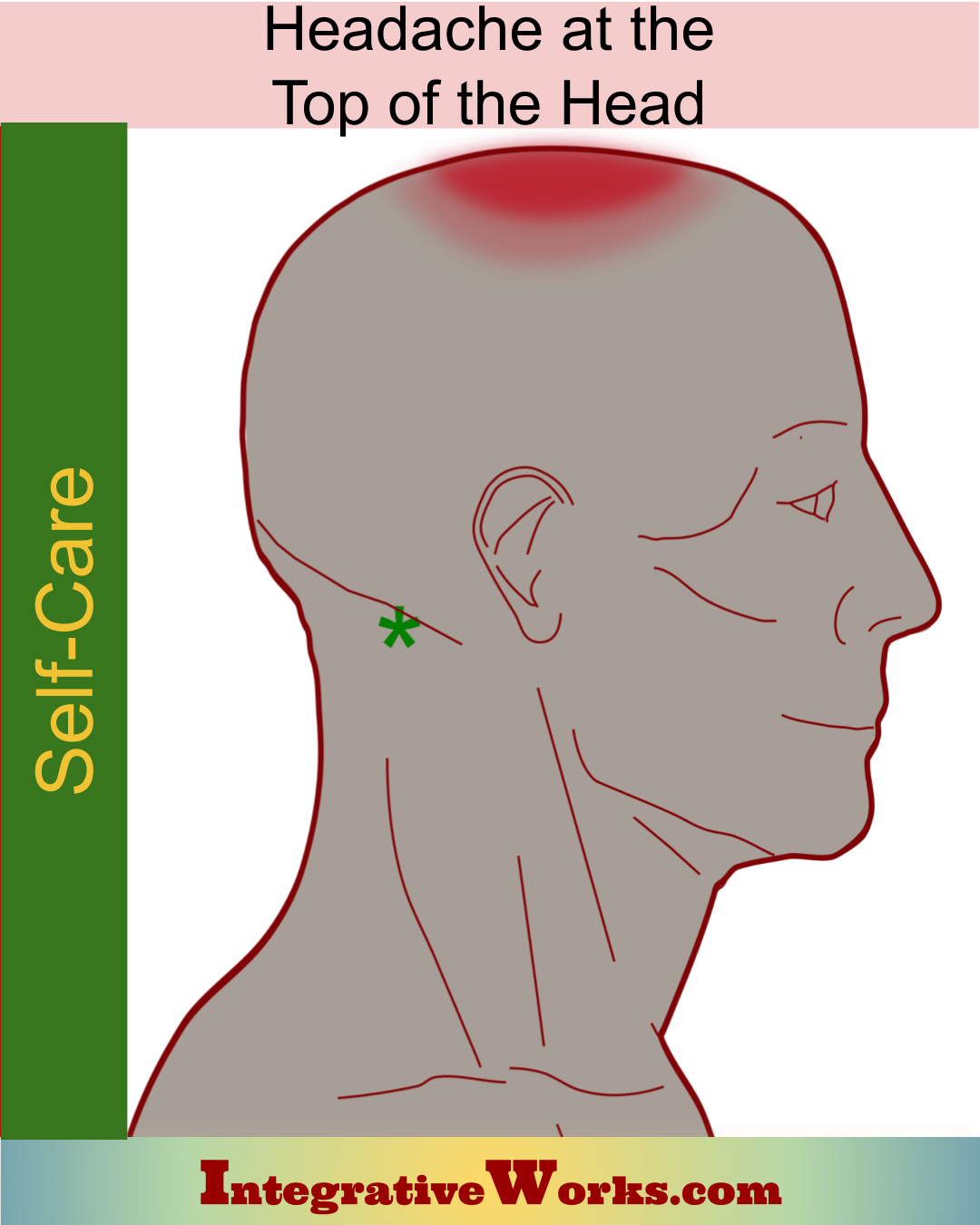 Self Care - Headache on the Top of Your Head - Integrative Works