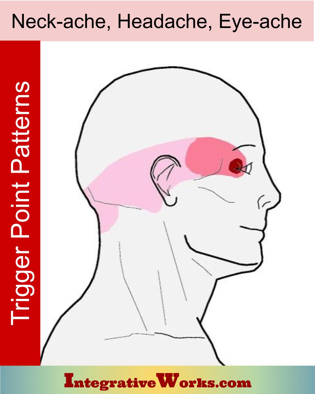 Neck ache Headache Eye ache Integrative Works
