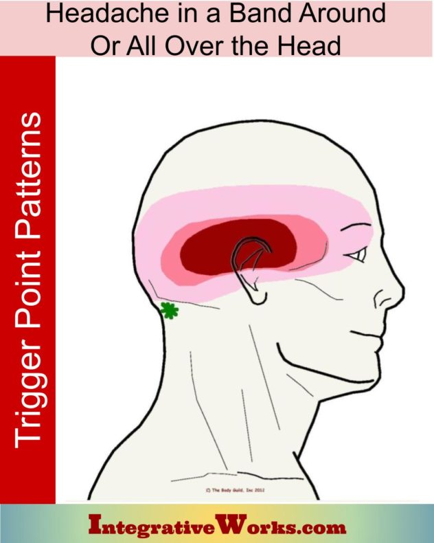 Cervicogenic Headache: Pain Patterns, Causes, and Self-Care ...