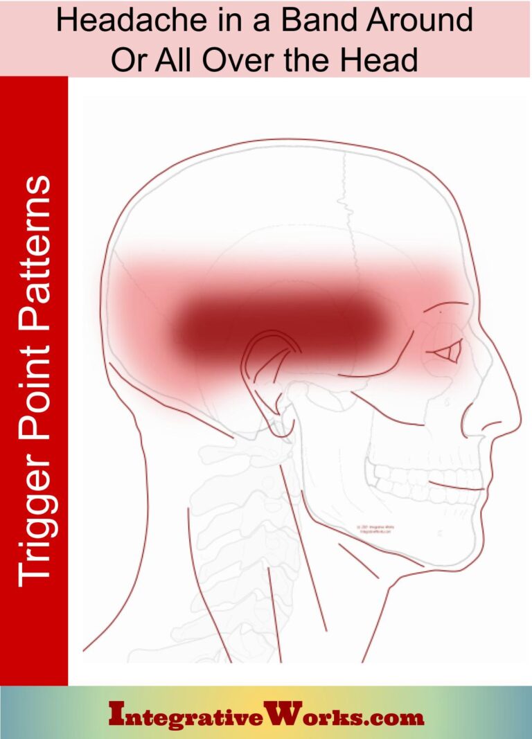 Headache All Over Or In A Band Around The Head - Integrative Works