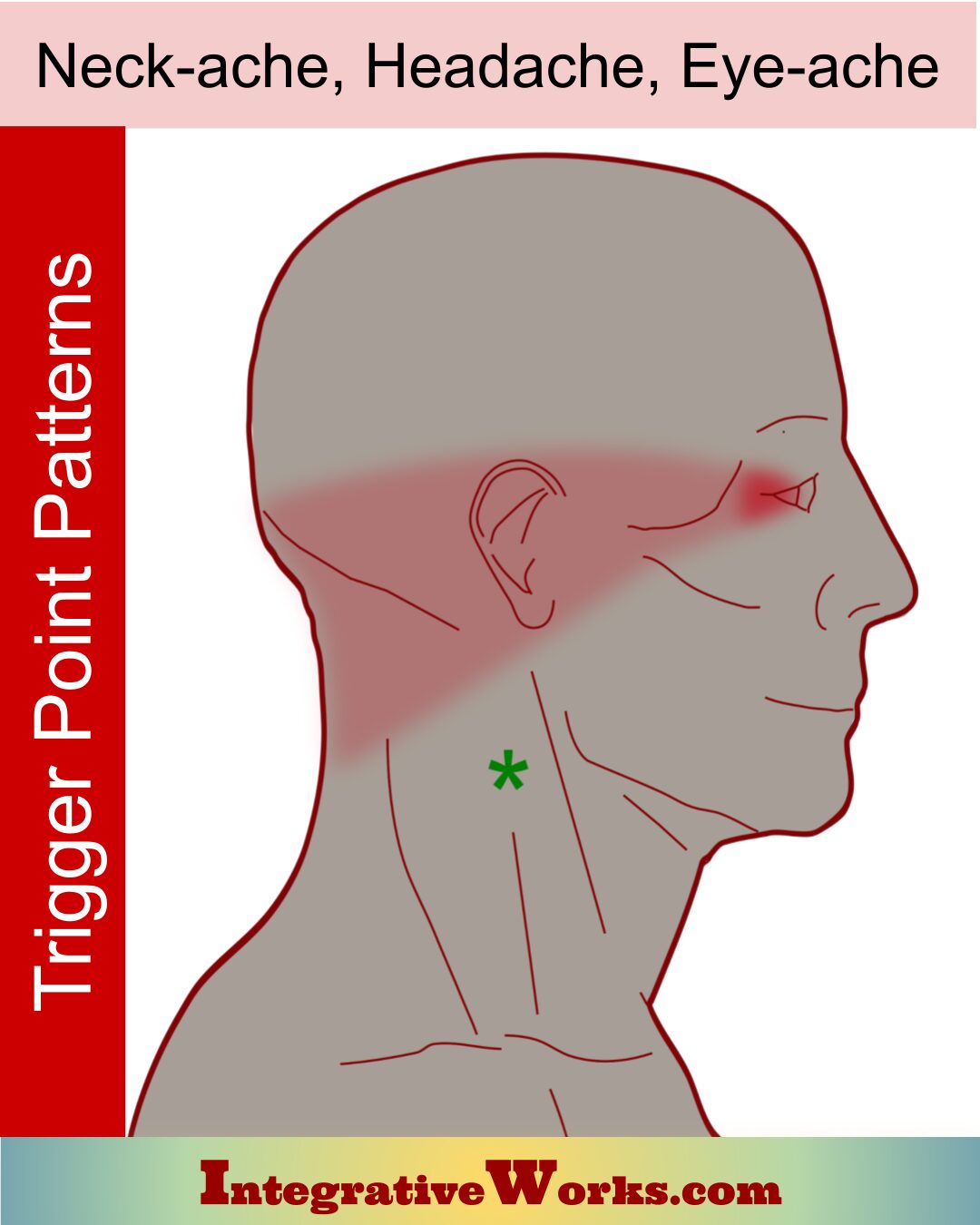 Trigger Point Pain Referral - Head - Integrative Works