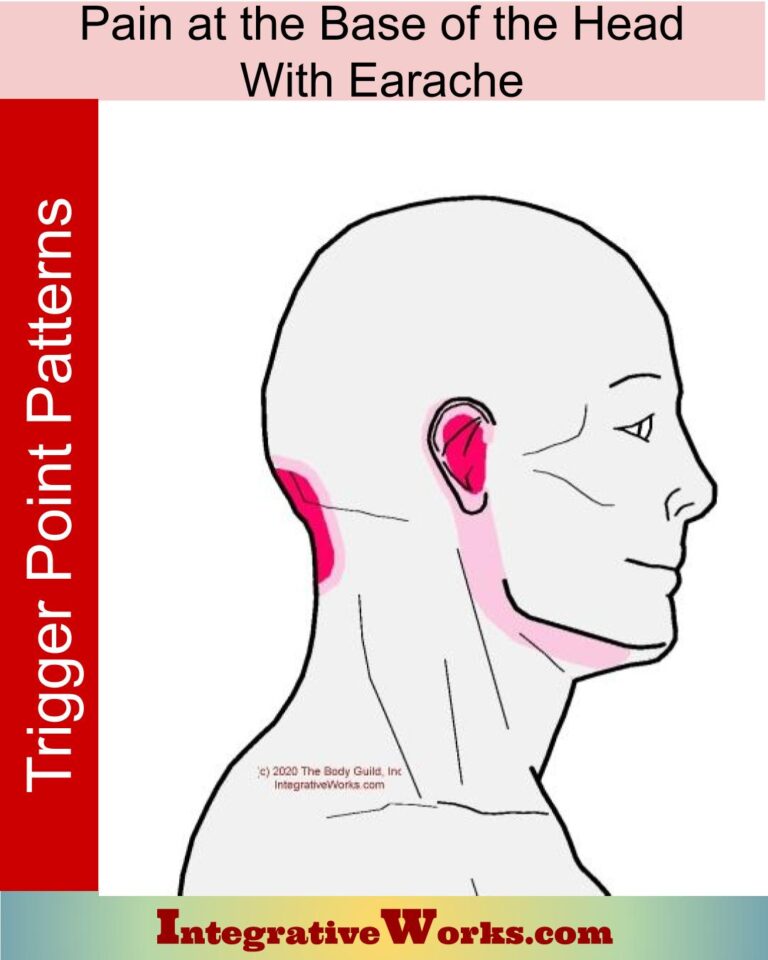 Pain In The Base Of The Head With Earache - Integrative Works