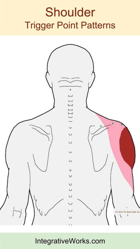 Shoulder - Pain and Impaired Function - Integrative Works