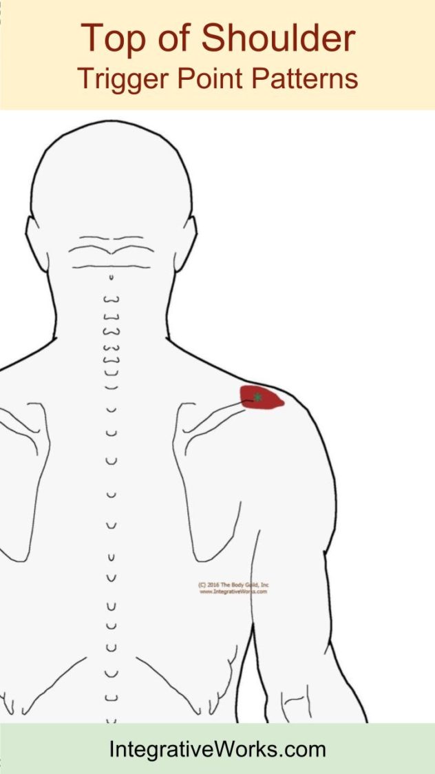 Shoulder - Pain and Impaired Function - Integrative Works