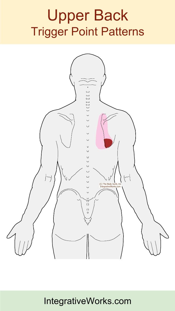Back - Pain and Impaired Function - Integrative Works