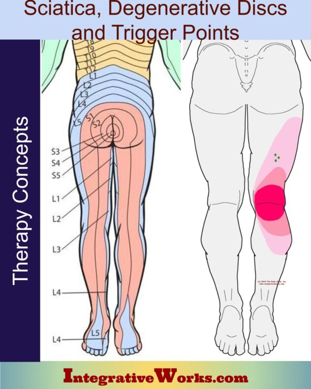 Sciatica, Degenerative Discs and Trigger Points - Integrative Works