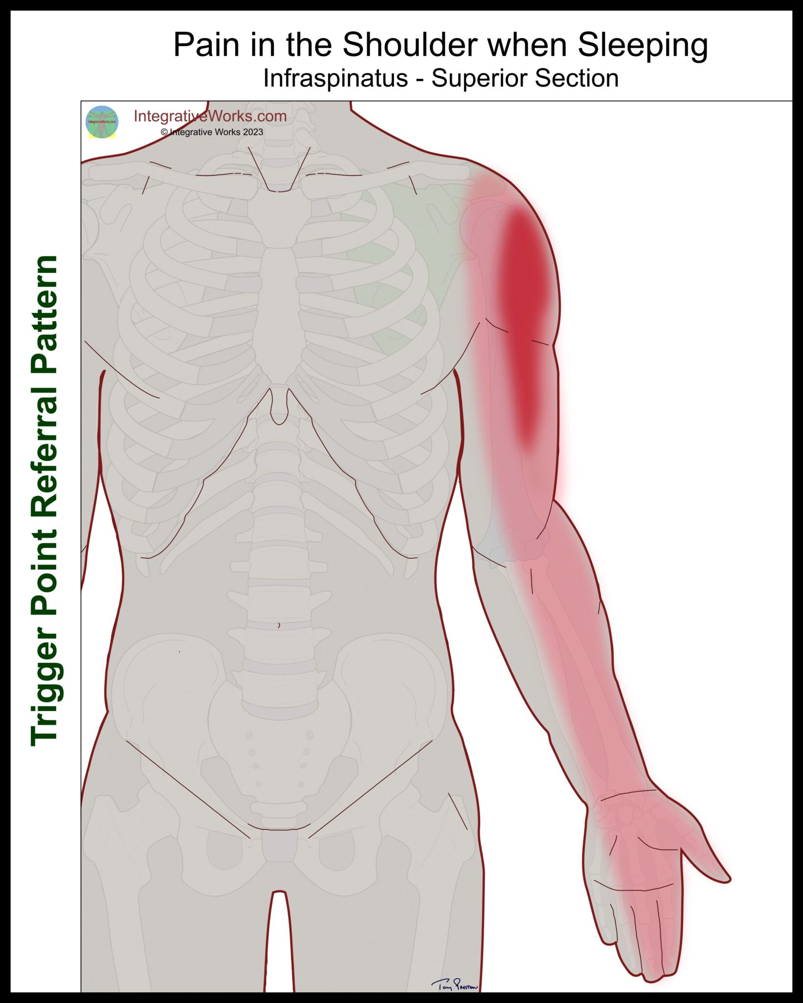 Shoulder pain when sleeping on your side - Integrative Works