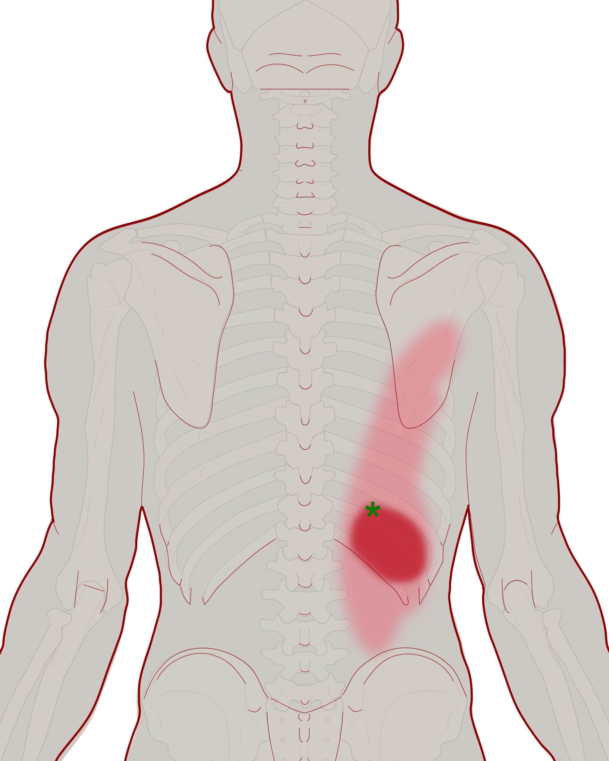 Mid back Pain with Stiff Low Back - Integrative Works