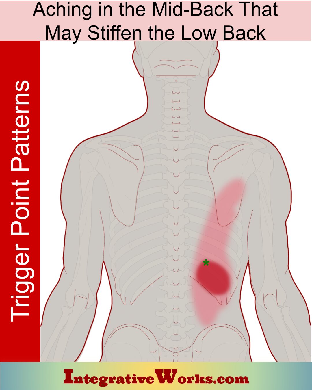 mid-back Archives - Integrative Works