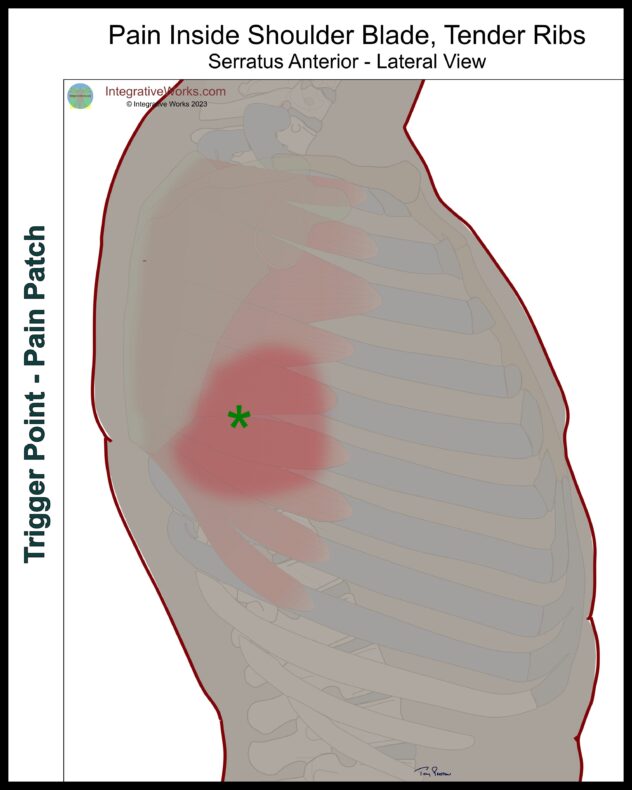 Nagging Pain Inside The Bottom of the Shoulder Blade - Integrative Works