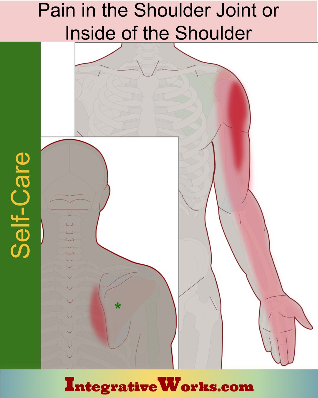 Self Care - Pain in Shoulder Joint or Inside Shoulder Blade ...