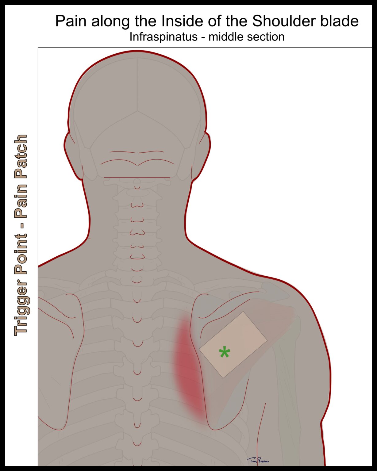 Self Care - Pain in Shoulder Joint or Inside Shoulder Blade ...