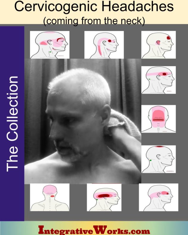 Trigger Point Patterns - Headaches - Cervicogenic - Integrative Works
