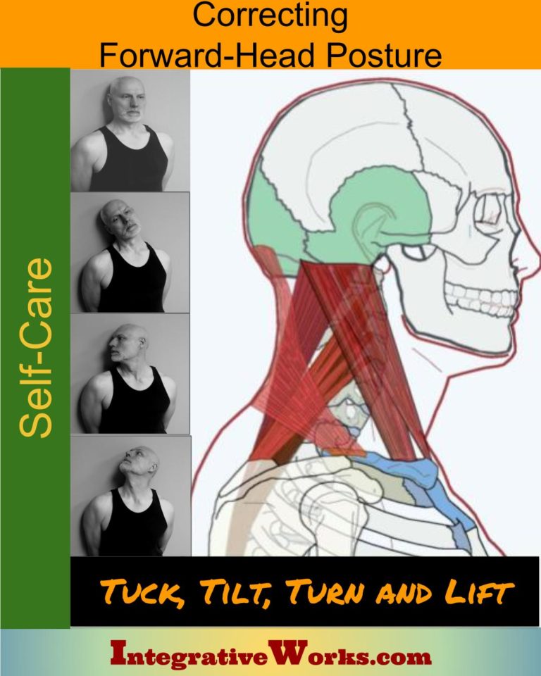 Thoracic Outlet Syndrome: Pain Patterns, Causes, Self-Care ...