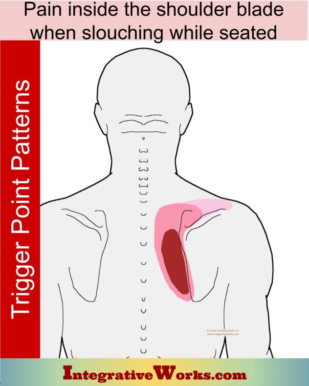 Pain Between Shoulder Blades Pain Patterns Causes Self Care