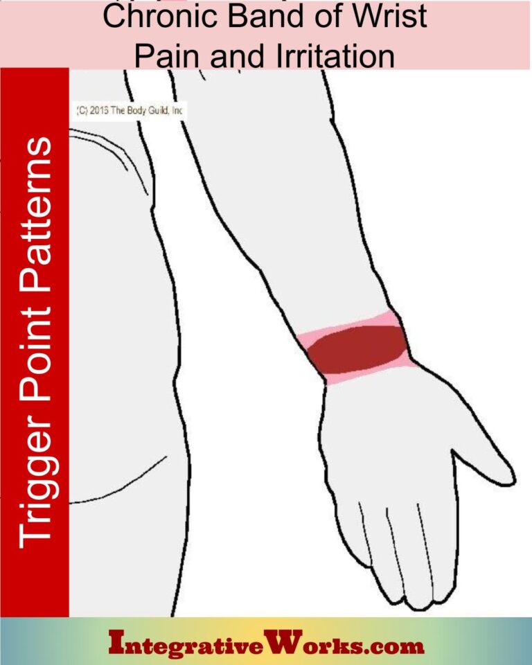 Chronic Band of Wrist Pain and Irritation - Integrative Works