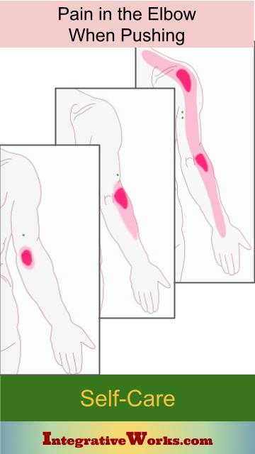Elbow Pain When Pushing - Integrative Works