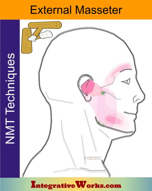 Masseter - External - Neuromuscular Massage Protocol - Integrative Works