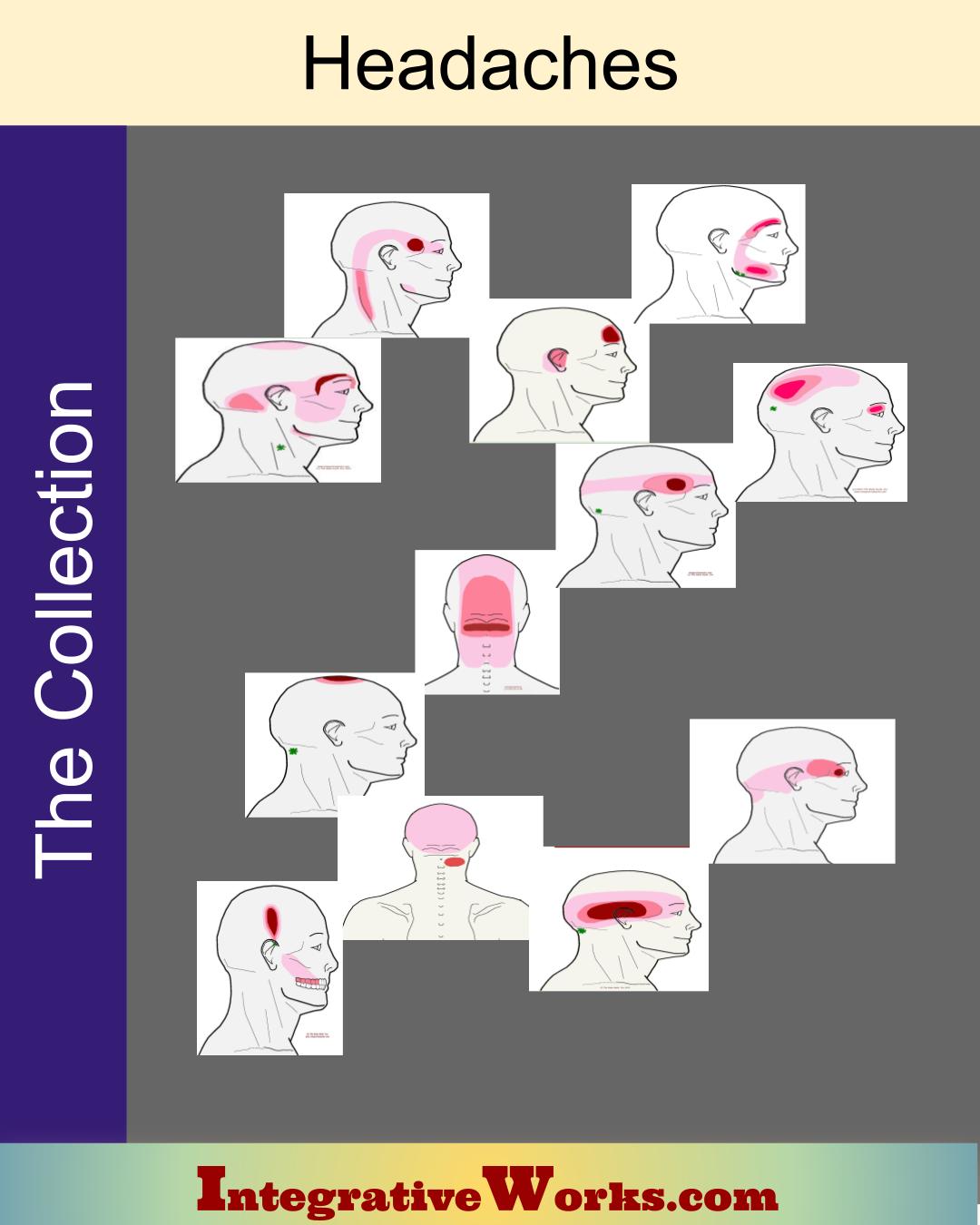 Trigger Point Patterns - Headache - Integrative Works