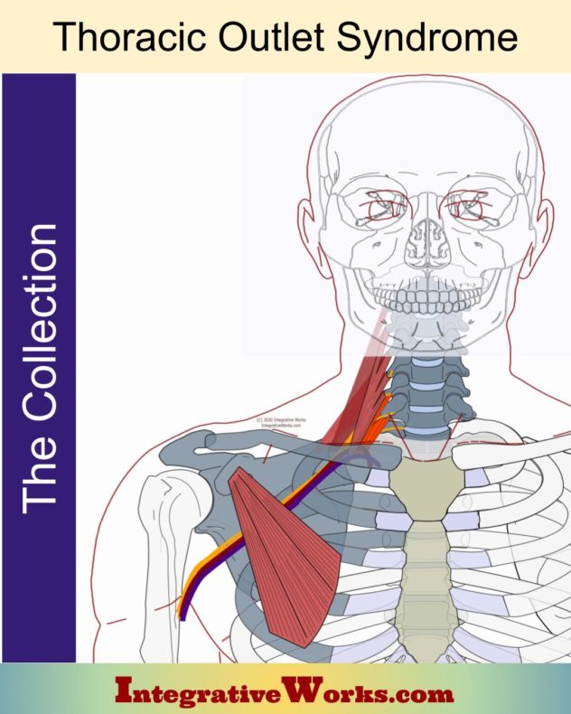 Thoracic Outlet Syndrome: Pain Patterns, Causes, Self-Care ...