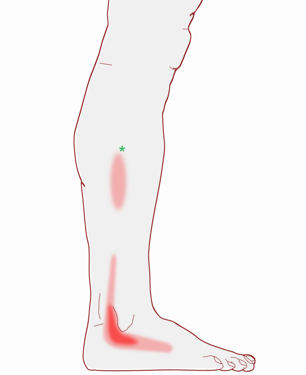 Painful, Unstable Ankle - Integrative Works