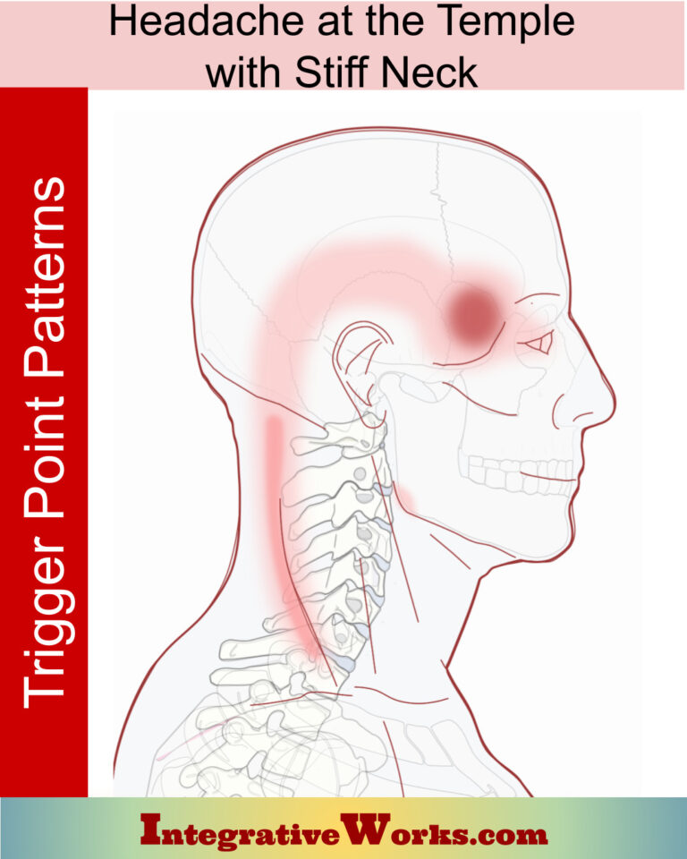 Headache At Your Temple with Stiff Neck - Integrative Works