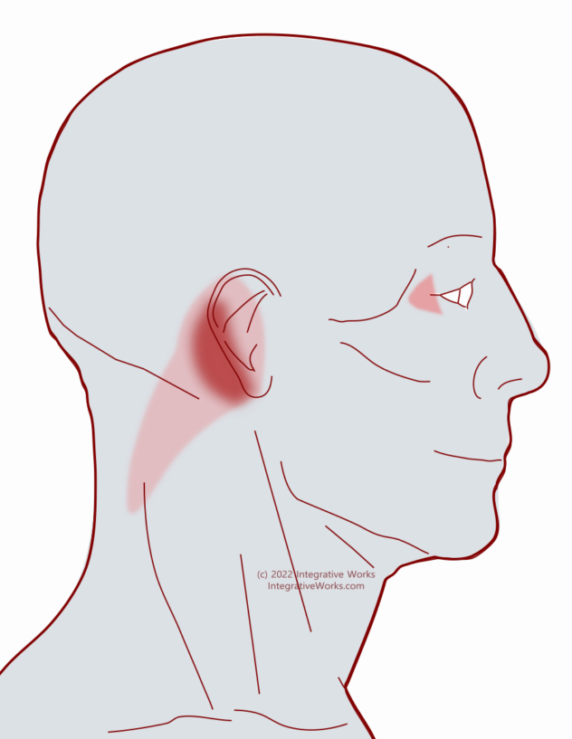 Pain Behind the Ear with Tension Down the Neck - Integrative Works