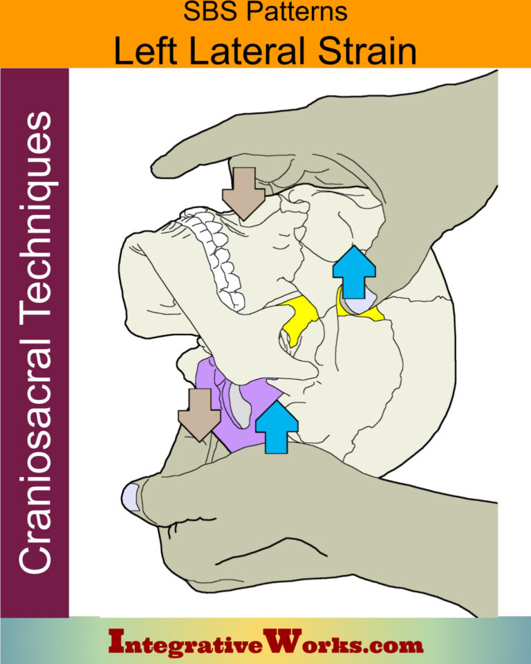Left Lateral Strain - SBS Assessment and Technique - Integrative Works