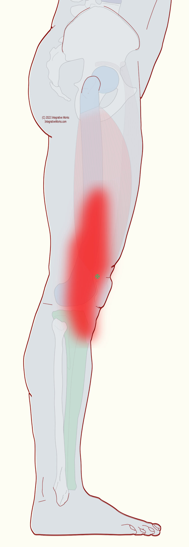 Pain Alongside of Thigh when Walking or Sleeping - Integrative Works