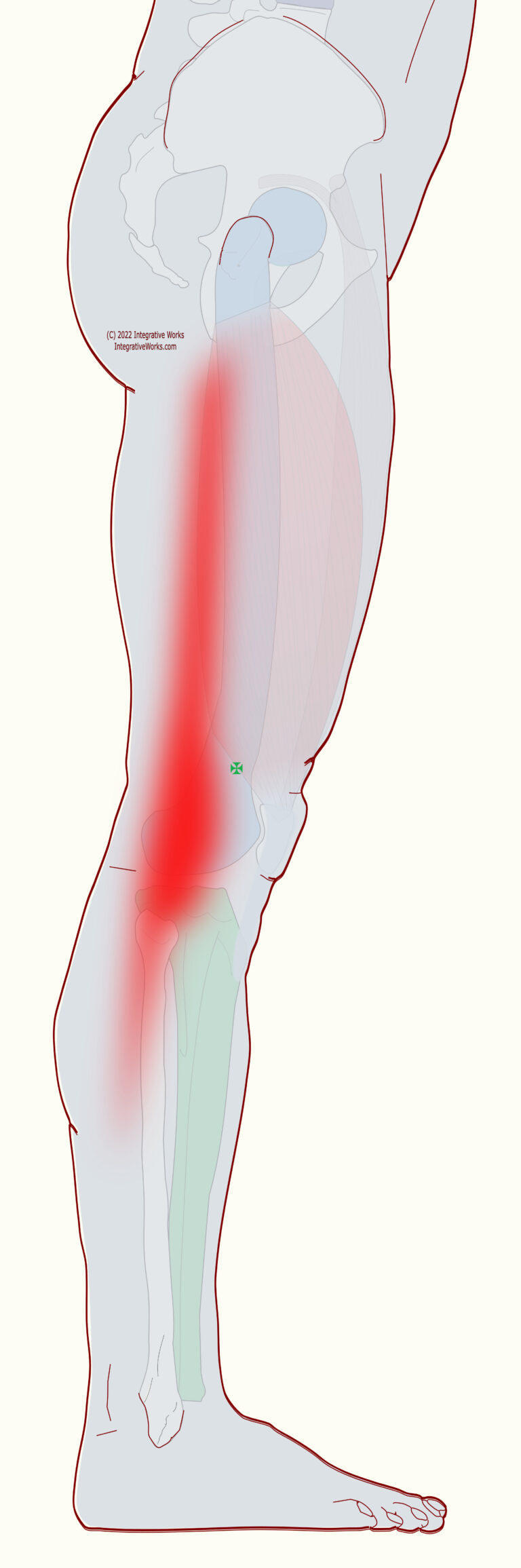 Pain Alongside of Thigh when Walking or Sleeping - Integrative Works