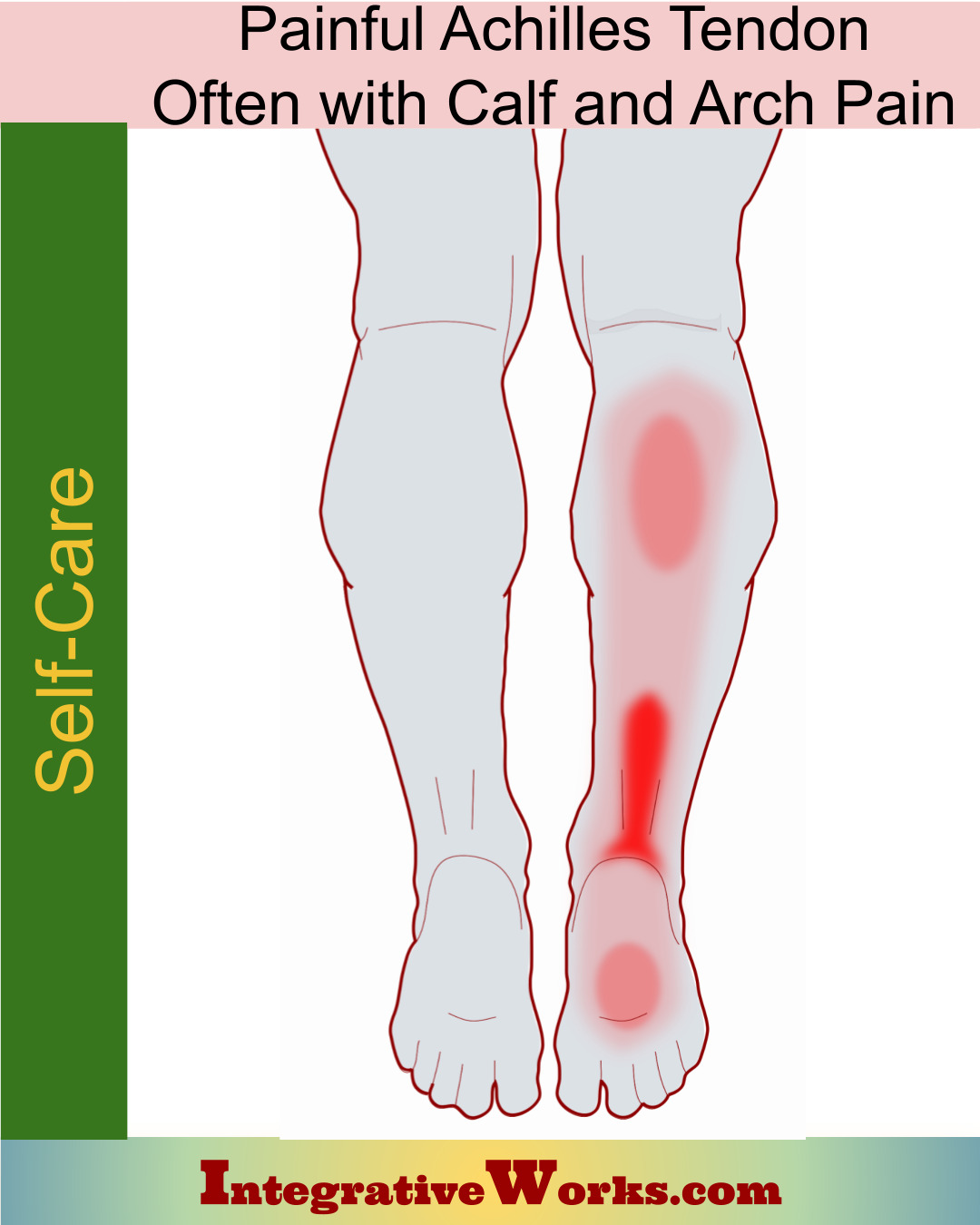 Self-Care - Pain in Achilles Tendon, Maybe Calf & Arch - Integrative Works
