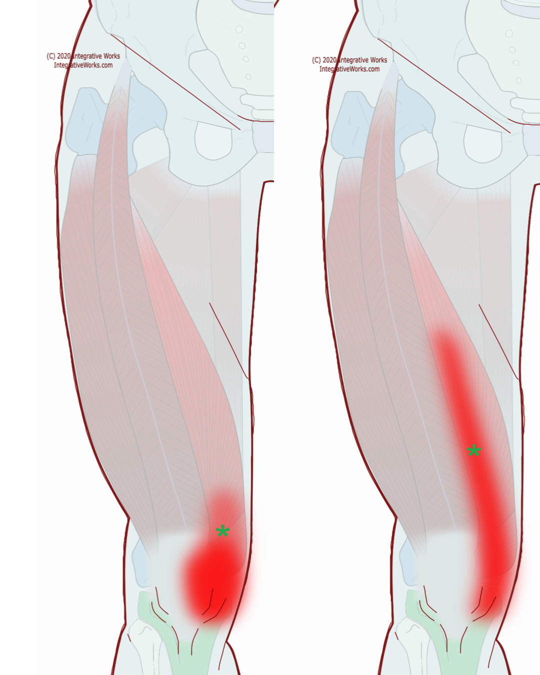 Pain Along Inside of Knee on Steps - Integrative Works