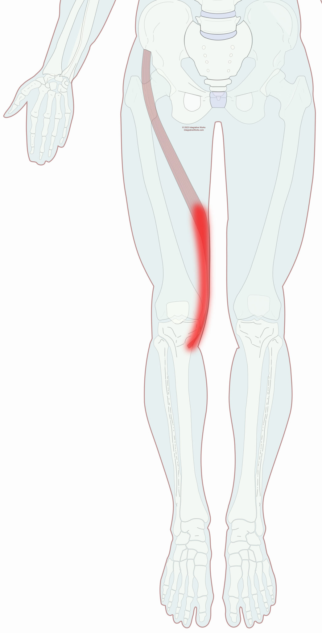 Pain Inside Knee. Sometimes Across Thigh - Integrative Works