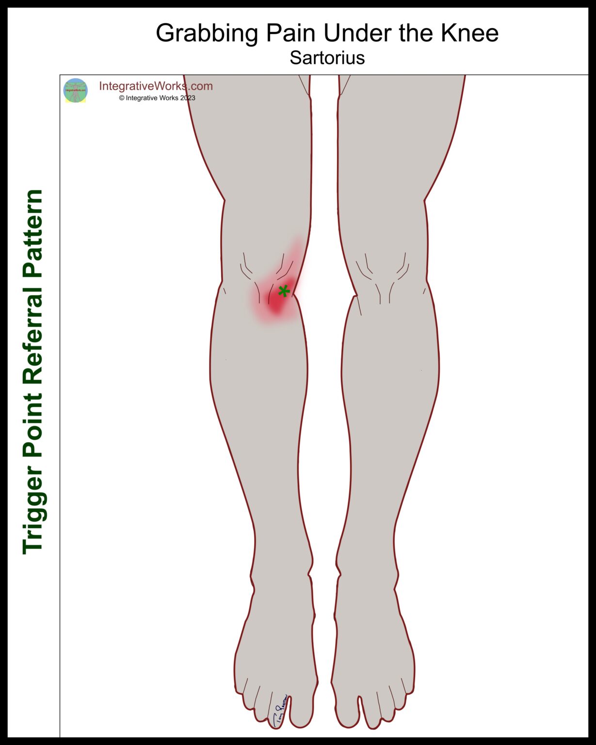 Pain Inside Knee. Sometimes Across Thigh - Integrative Works
