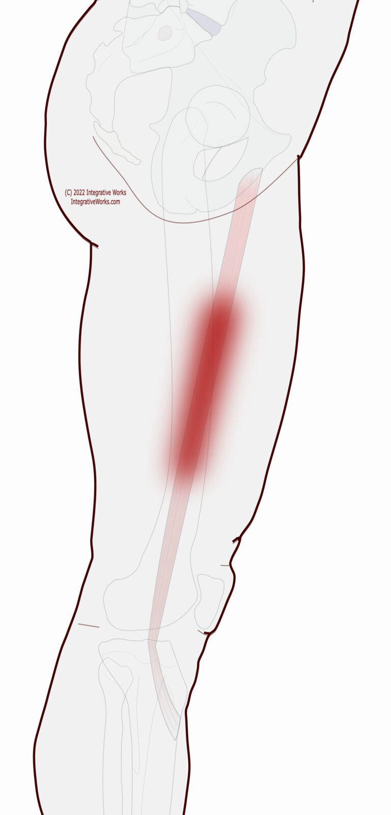 Warm, Superficial Irritation Along Inside of Thigh - Integrative Works