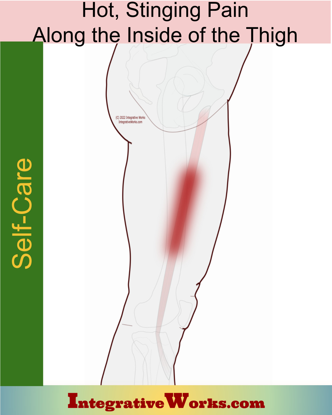 Warm, Superficial Irritation Along Inside of Thigh - Integrative Works