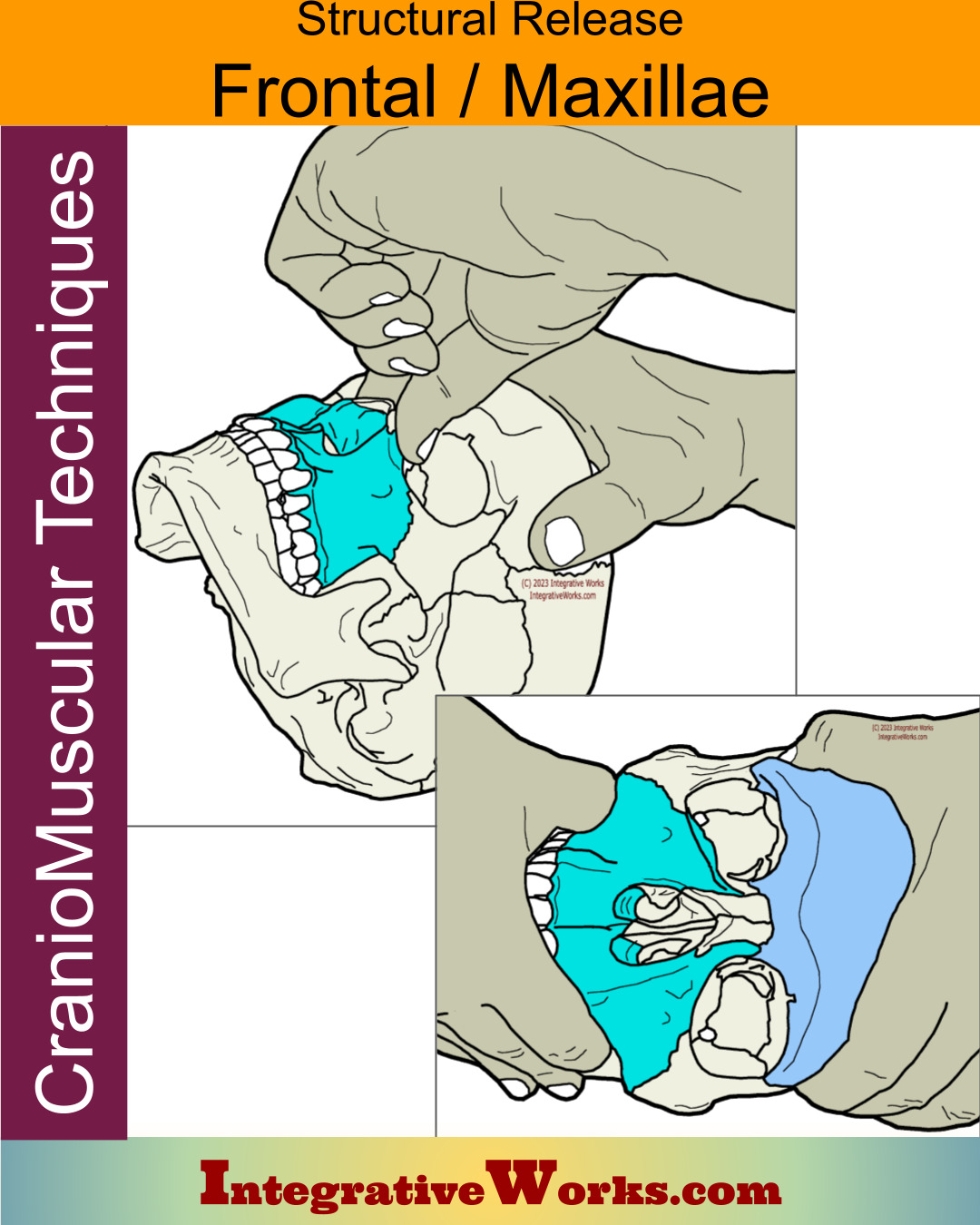 Structural Release of Frontal-Maxillae - Integrative Works