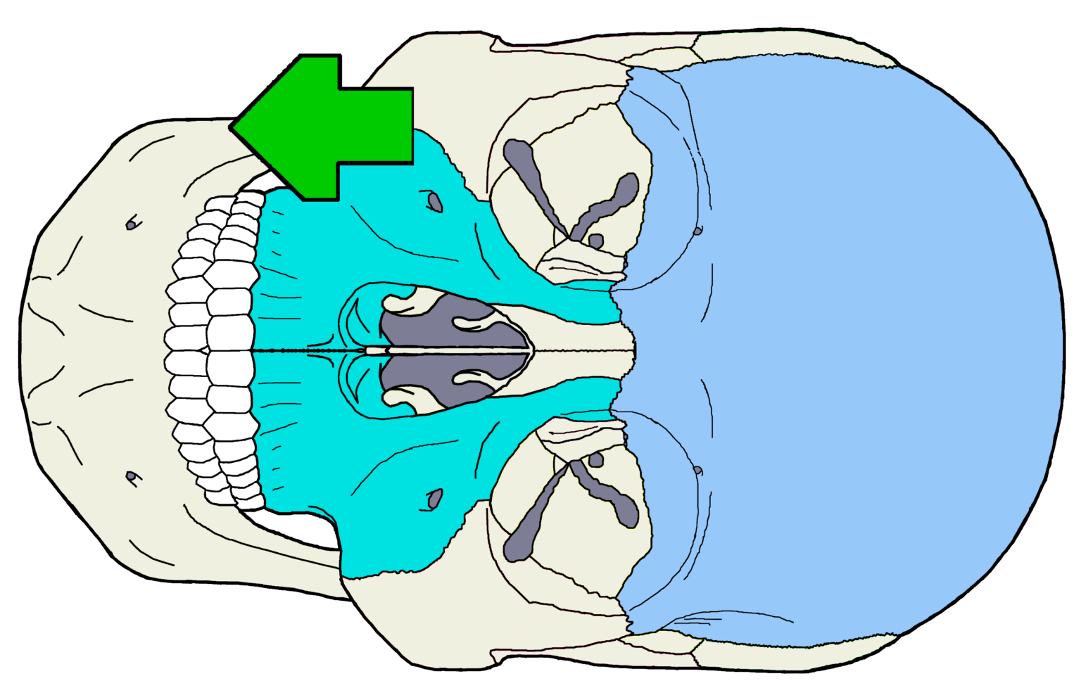 Structural Twist and Distraction of Frontal-Maxilla - Integrative Works