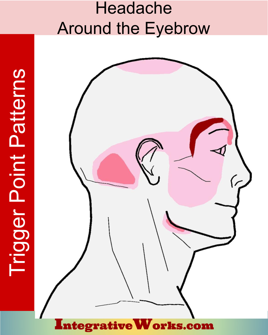 Headache Around The Eyebrow - Integrative Works