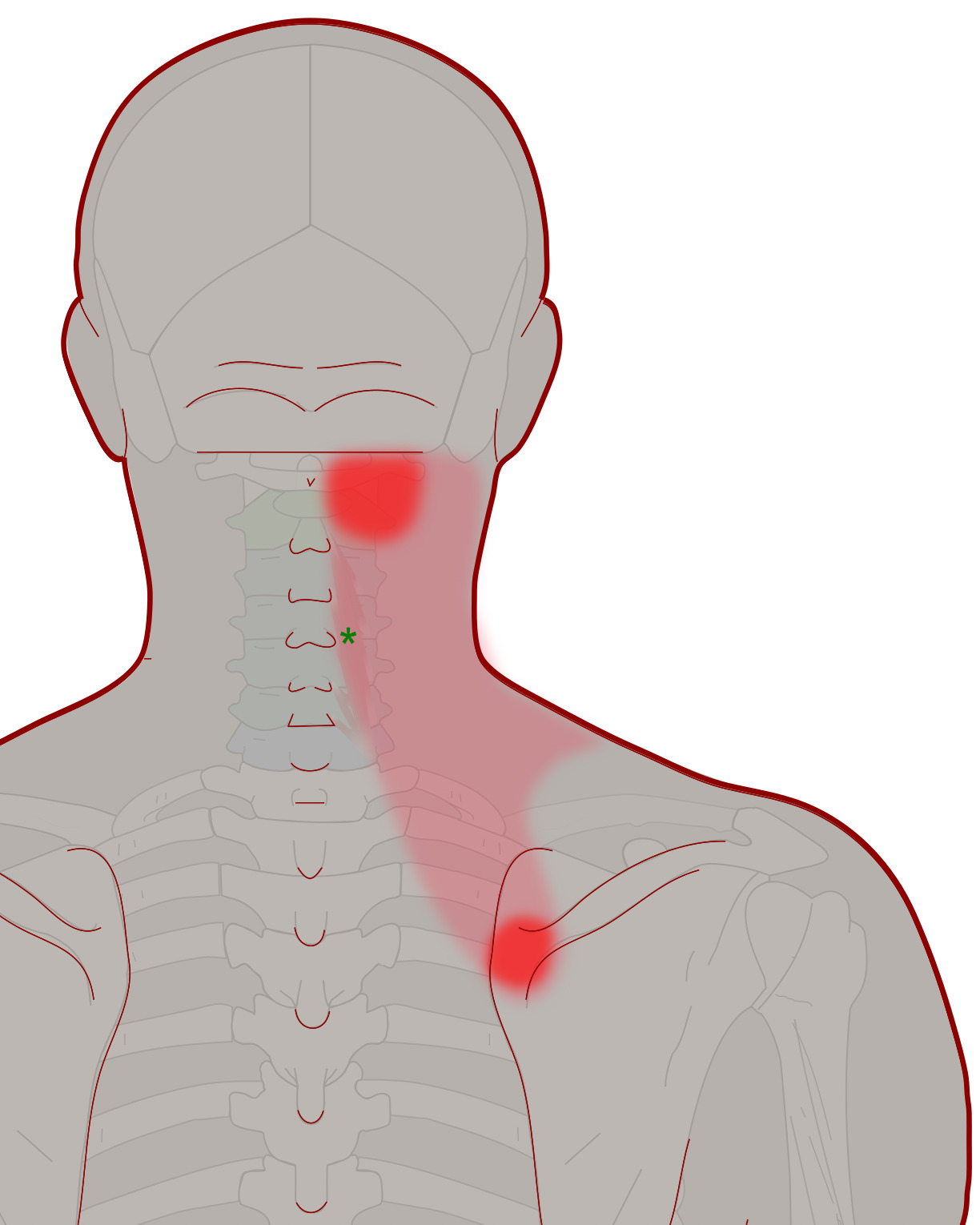 Pain at the Base of the Head and Under Shoulder Blade - Integrative Works