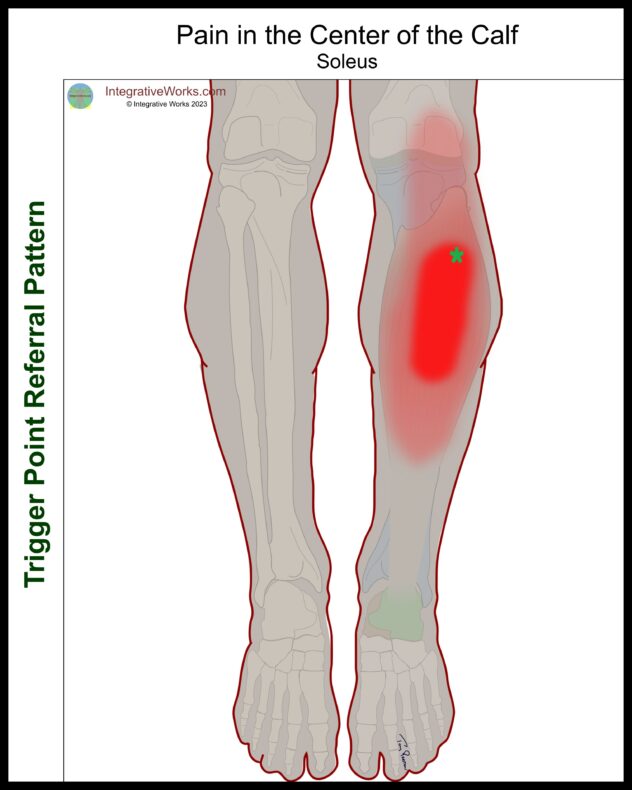 Pain Center of the Calf - Integrative Works