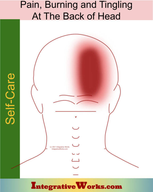 Pain, Burning & Tingling on Back of Head - Integrative Works