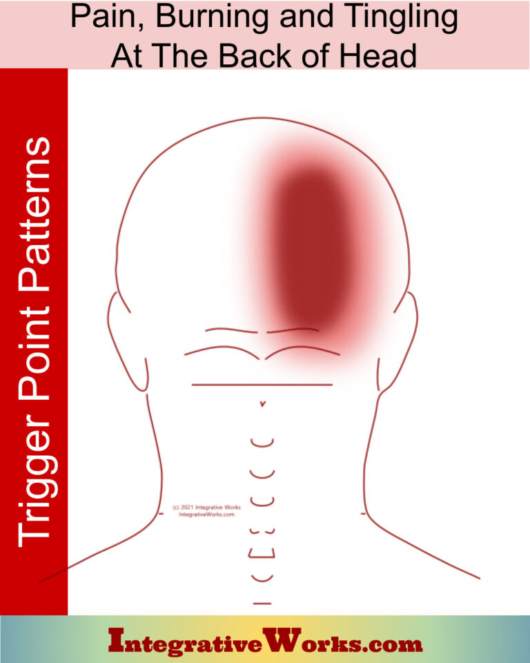 Head Pain Archives - Integrative Works